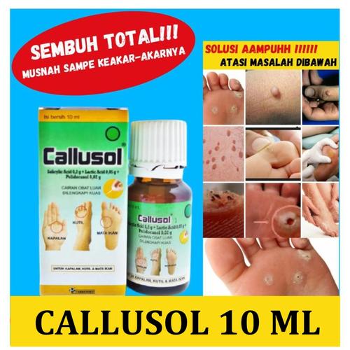 Jual Callusol obat kaki kapalan mata ikan dan penghilang kutil leher ...