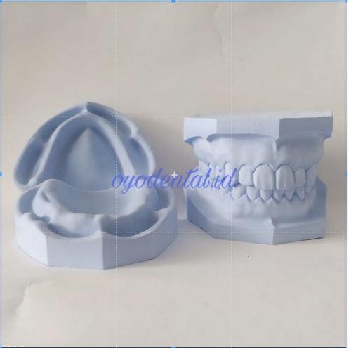 Jual dental model study gips / model gigi gipsum / model study gypsum ...