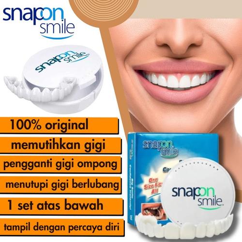 Jual BISA COD Snap On Smile 100% ORIGINAL Authentic / Snap on Smile Gigi - Jakarta Timur ...