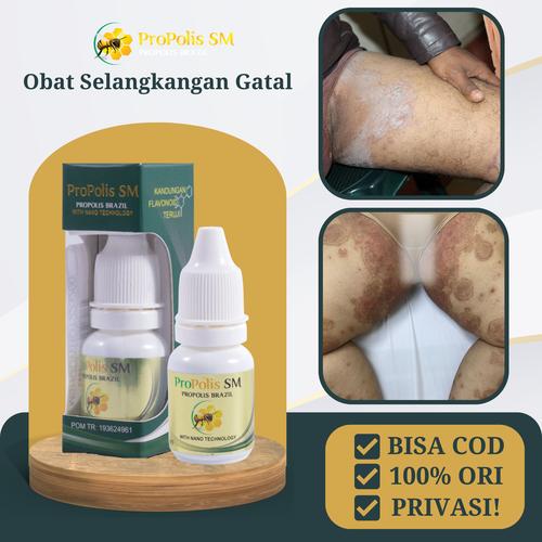 Jual Obat Selangkangan Hitam Dan Gatal,Selangkangan Lecet Berjamur ...