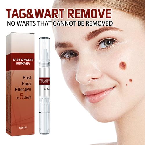Jual Wipe Off Tags Moles Remover Wart Removal Pen Penghilang Tahi Lalat ...