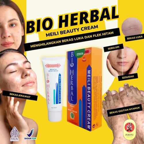 Jual Obat Salep Cream Krim Penghilang Bekas Luka Bio Herbal ...