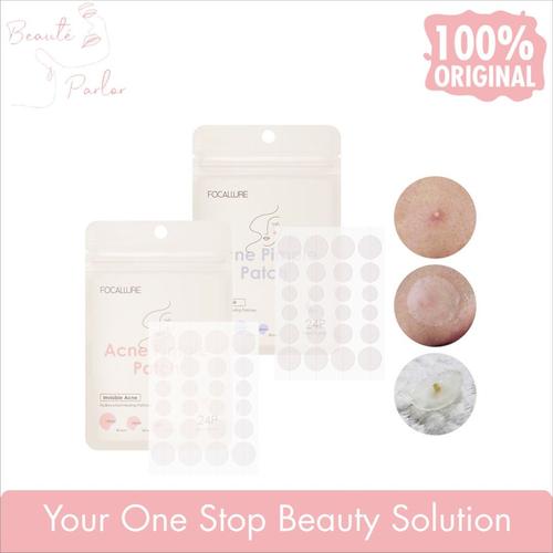 Jual Focallure Spot Patch Acne Treatment Day/Night Pimple Spot ...