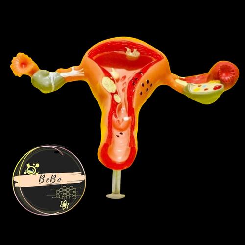 Jual Alat Peraga Anatomi Rahim / Uterus and Ovaries (Normal ...