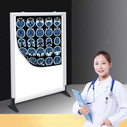 Jual Alat Bantu Baca Rontgen Film Viewer Lampu Baca Rontgen Light Box X ...