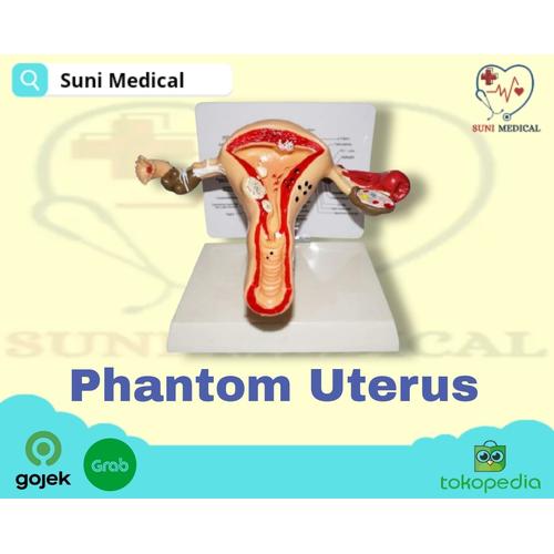 Jual Phantom Uterus / Manikin Uterus / Peraga Uterus atau Rahim Wanita ...