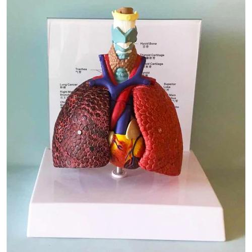 Jual alat Peraga/Paru-Paru Manusia Model Sistem Pernapasan/Model Paru ...