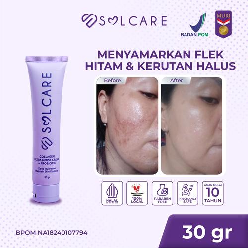 Promo COLLAGEN CREAM BOPENG ACNE SCAR - SOLCARE - SerumFREEtoner - Kota ...