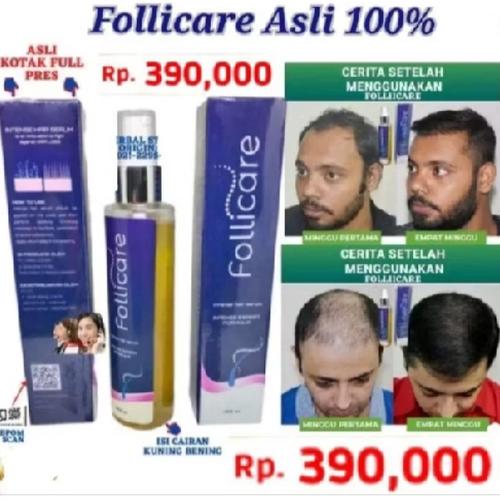 Jual FOLLICARE Serum Obat Rambut Fellicare Asli Original Berkualitas ...