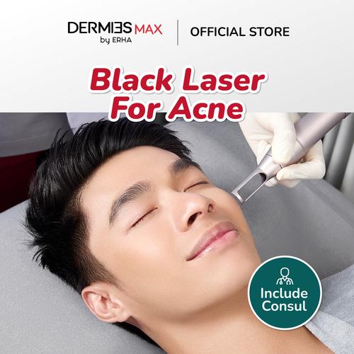 Jual Dermies Max Black Laser for Acne - Jakarta Barat - Dermies Max ...