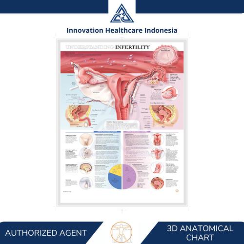 Promo 3D Anatomical Chart Understanding Infertility - Poster Edukasi ...