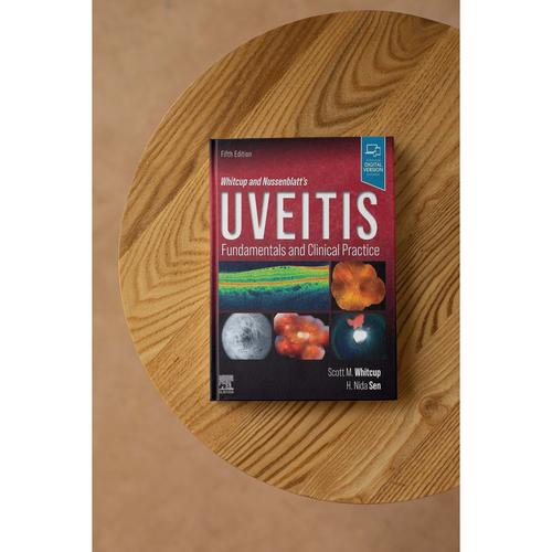 Jual Whitcup and Nussenblatt's Uveitis, Fundamentals and Clinical ...