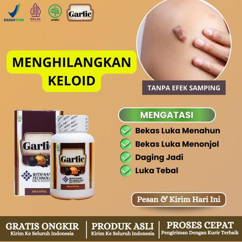 Jual Black Garlic Obat Keloid, Bekas Luka Menahun, Penghilang Bekas ...