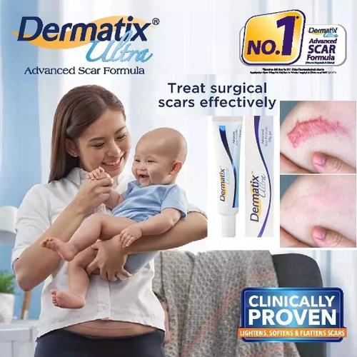 Jual Dermatix Ultra Gel untuk Mengatasi Bekas Luka OBAT Keloid 15Gr ...
