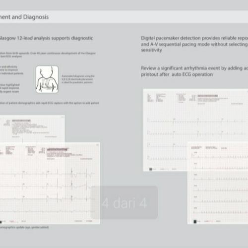 Jual Mindray R12 ECG paper for model R12 - Jakarta Barat - starmed ...