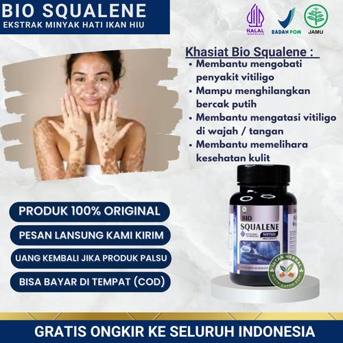 Jual Bio Squalene Obat Vitiligo, Bercak Putih Di Kulit, Vitiligo Di ...