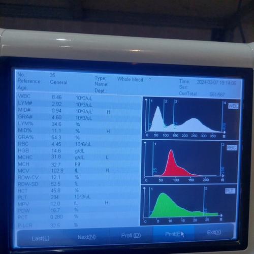 Jual HEMATOLOGY RAYTO WAPLAB ZENIX OPEN SYS SECOND TERASA BARU - Kota ...
