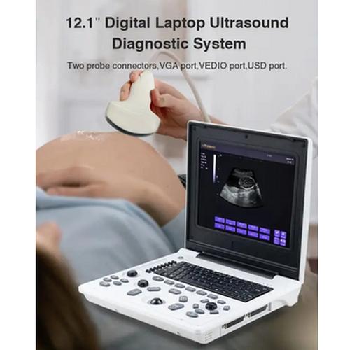 Jual Portable medical ultrasound Scanner USG Mini USG Untuk Hewan ...