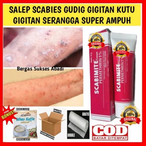 Jual SALEP SCABIES GUDIG GIGITAN KUTU GIGITAN SERANGGA SUPER AMPUH - 30 ...