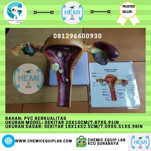 Jual ANATOMI ALAT PERAGA PENDIDIKAN RAHIM FEMALE UTERUS OVARY DISEASE ...