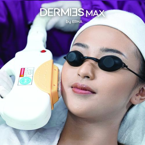 Promo Dermies Ultra Glow Treatment by IPL - Jakarta Barat - Dermies Max ...
