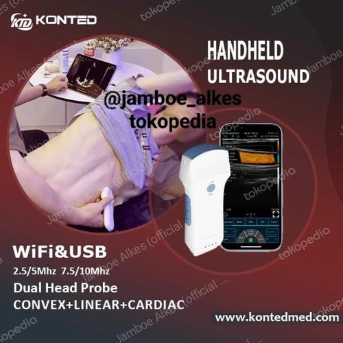 Jual USG 2 Head Wireless/Ultrasound probe 3in1 (Convex, Linear ...