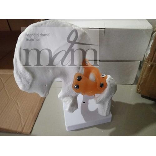 Jual Alat Peraga Tulang Pinggul - Human Hip joint - Kab. Bogor ...