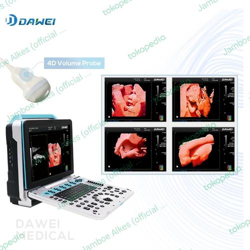 Jual USG 3D/4D Colour Doppler Ultrasound System 2 Probe - Kab ...
