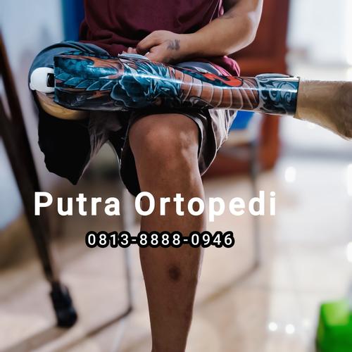 Jual Kaki Palsu Bawah Lutut [Advance] - Kota Bekasi - Kurnia Putra Ortopedi | Tokopedia
