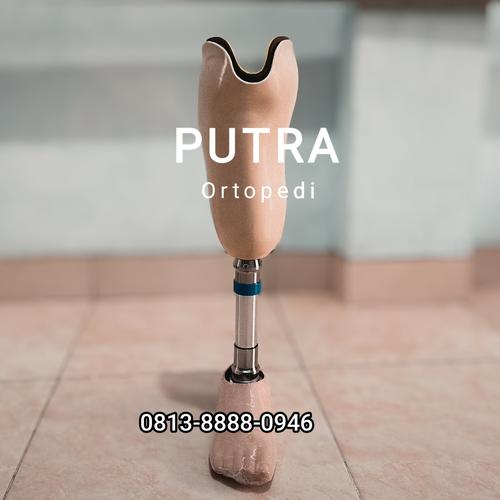 Jual Kaki Palsu / Kaki Palsu Bawah Lutut / kaki palsu atas lutut - Kota Bekasi - Kurnia Putra ...