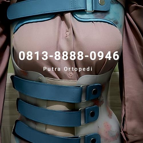 Jual Brace Skoliosis / Scoliosis Brace Jakarta - Kota Bekasi - Kurnia Putra Ortopedi | Tokopedia
