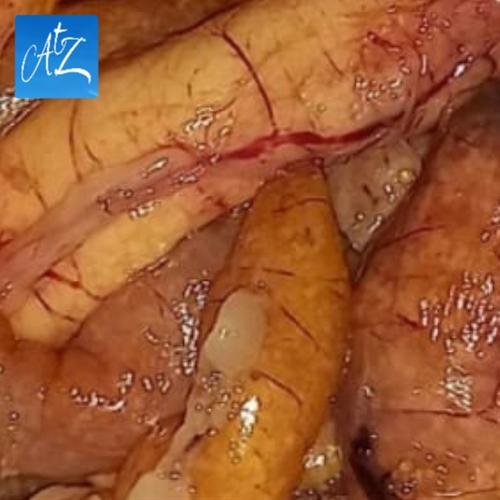 Jual Telur telor ikan gabus mentah segar fresh 100g - Kota Medan ...