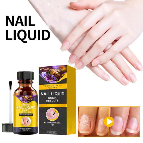 Promo Ximonth Nail Liquid 15ml Nail Fungus Treatment Serum Paronychia ...