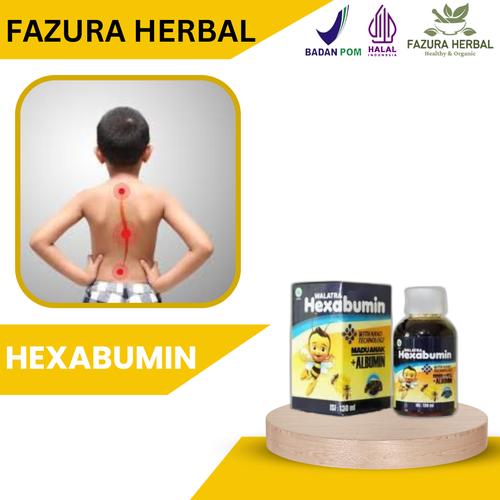 Jual Hexabumin - Obat Skoliosis Anak, Obat Penguat Tulang Anak, Obat ...