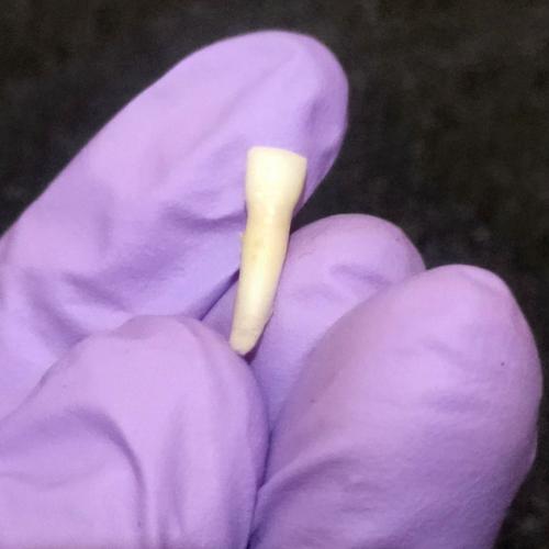 Jual gigi insisivus/ gigi susu / gigi praktikum / gigi insisivus bawah ...