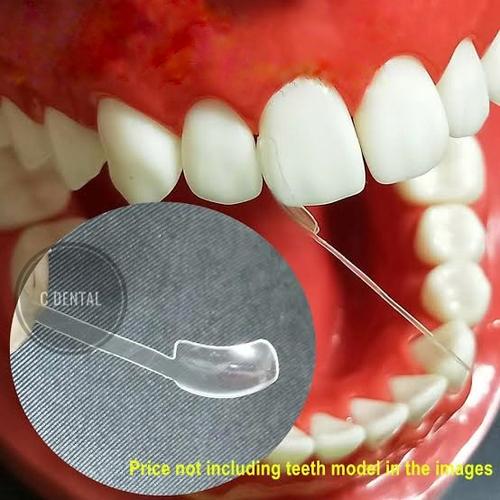 Jual Dental Anterior Matrix Transparan Proximal Strip Bahan Poliester ...