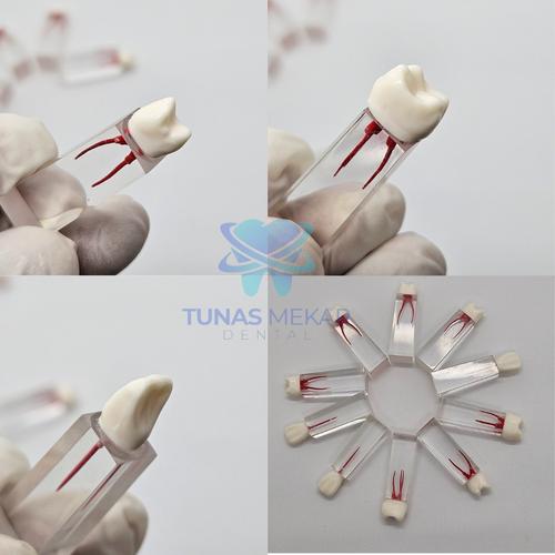 Jual Dental Model Gigi Phantom Artificial PSA Saluran Akar Endo - molar ...