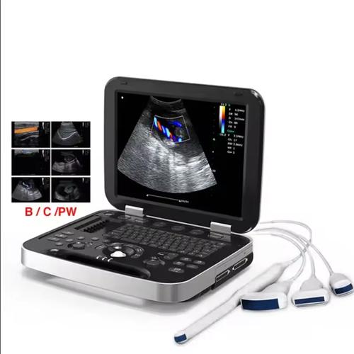 Jual Medical Echo Echocardiography Cardiac laptop gynecological ...