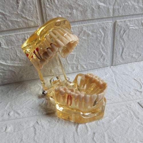 Jual Phantom gigi Dewasa Transparan Dental Model gigi Praktikum Dokter ...