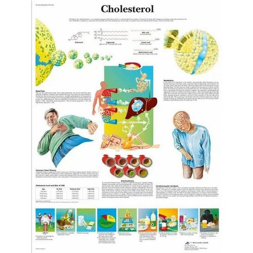 Jual POSTER SISTEM METABOLISME CHOLESTEROL - A3 + Artpaper - Jakarta ...