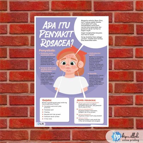 Jual Poster Kesehatan Apa itu penyakit Rosacea - Kota Surabaya ...