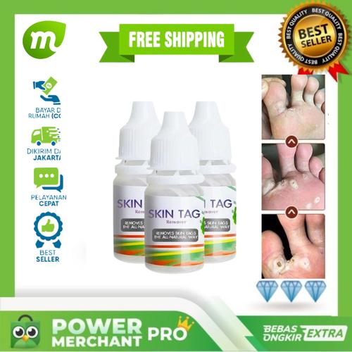 Jual Obat Mata Ikan Ampuh - Obat Mata Ikan di Telapak Kaki dan Tangan ...