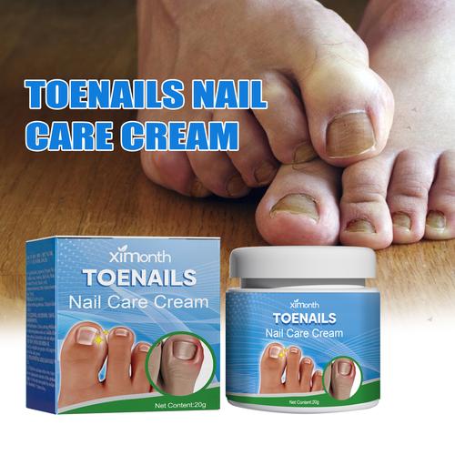 Promo Toenail Repair Cream Fungal Nail Treatment Anti Toe Fungus ...