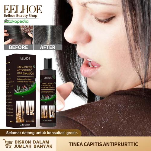 Jual EELHOE Tinea Capitis Antipruritic Hair Shampoo Treatment Scalp ...