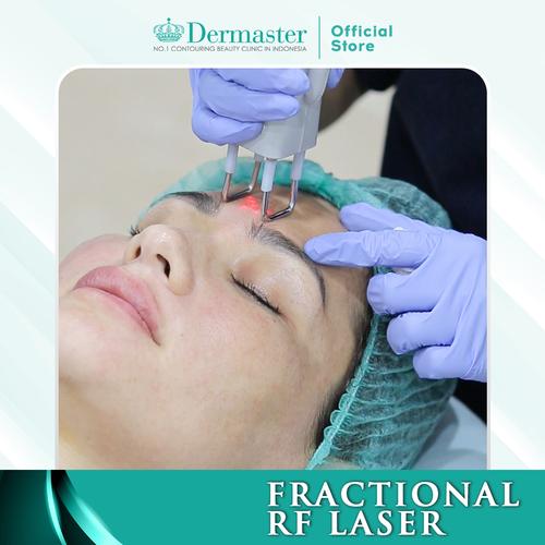 Promo Dermaster Fractional RF Laser Treatment Cicil 0% 3x - Jakarta Pusat - Dermaster_NEW ...