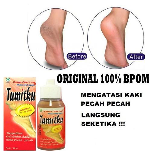 Jual TUMITKU MENGATASI KAKI PECAH/KAPALAN DENGAN INSTAN BPOM - Jakarta ...
