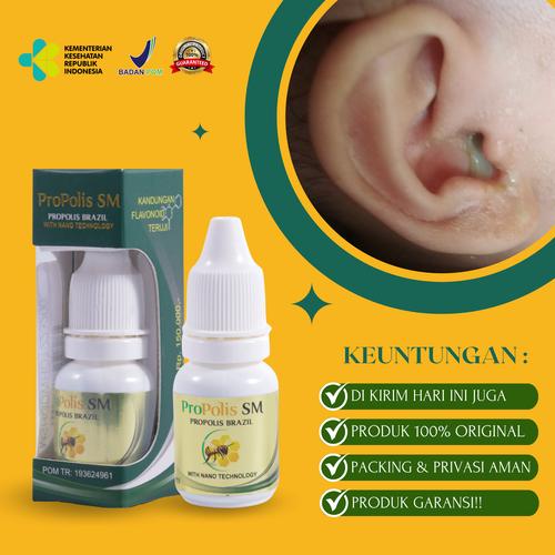 Jual Propolis Sm - Tetes Telinga Conge Curek Berair Bernanah Bau dan ...