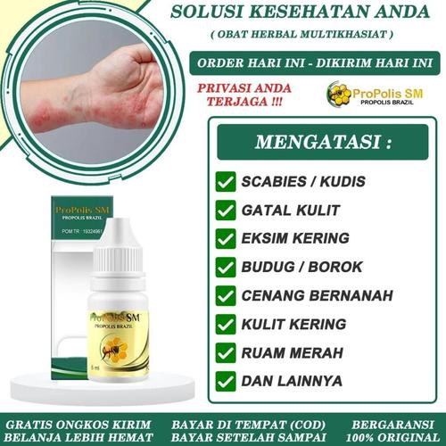 Jual Readyy Obat Scabies Manusia Budug Kulit Gatal Borok Cenang ...