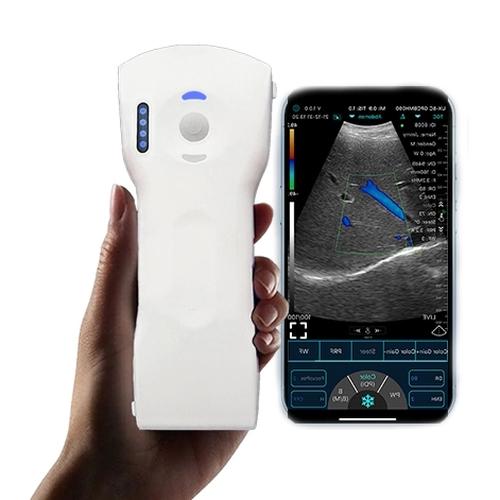 Jual USG WIRELESS / USG POCKET / USG WIFI DUAL PROBE 2 IN 1 ULTRASOUND ...