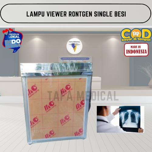 Jual Lampu Baca Foto Rontgen X Ray Film Medis Single Viewer - Kota ...